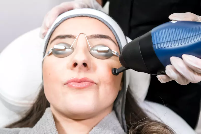 Láser Fraccionado CO2 Edge ONE™ - Clínica Mediderma