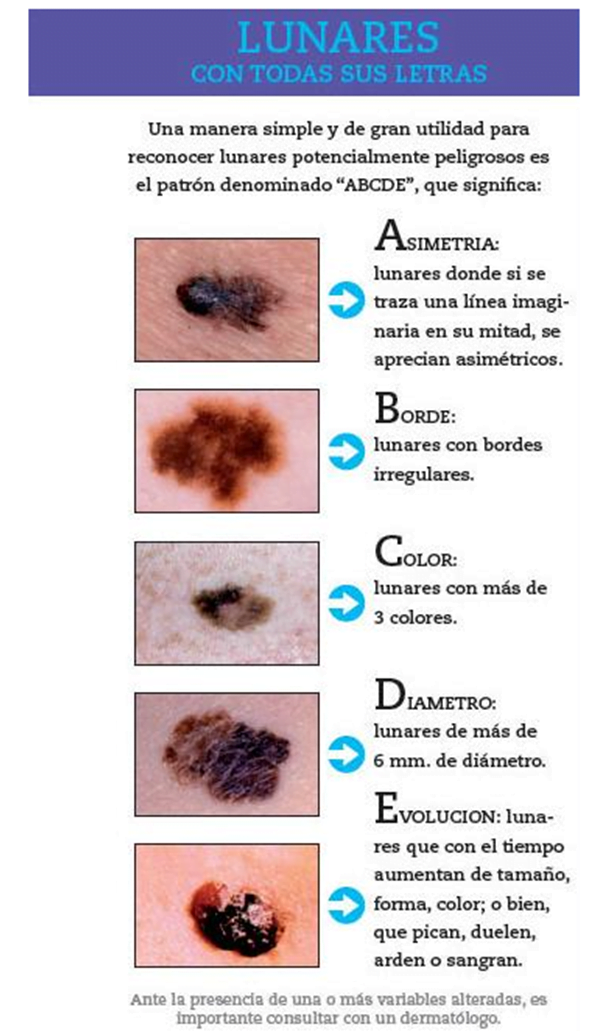 Lunares - Clínica Mediderma